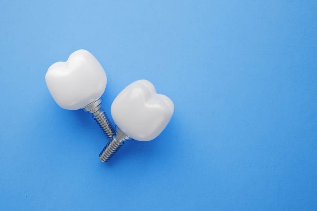 The Ultimate Guide to Natural-Looking Dental Implants